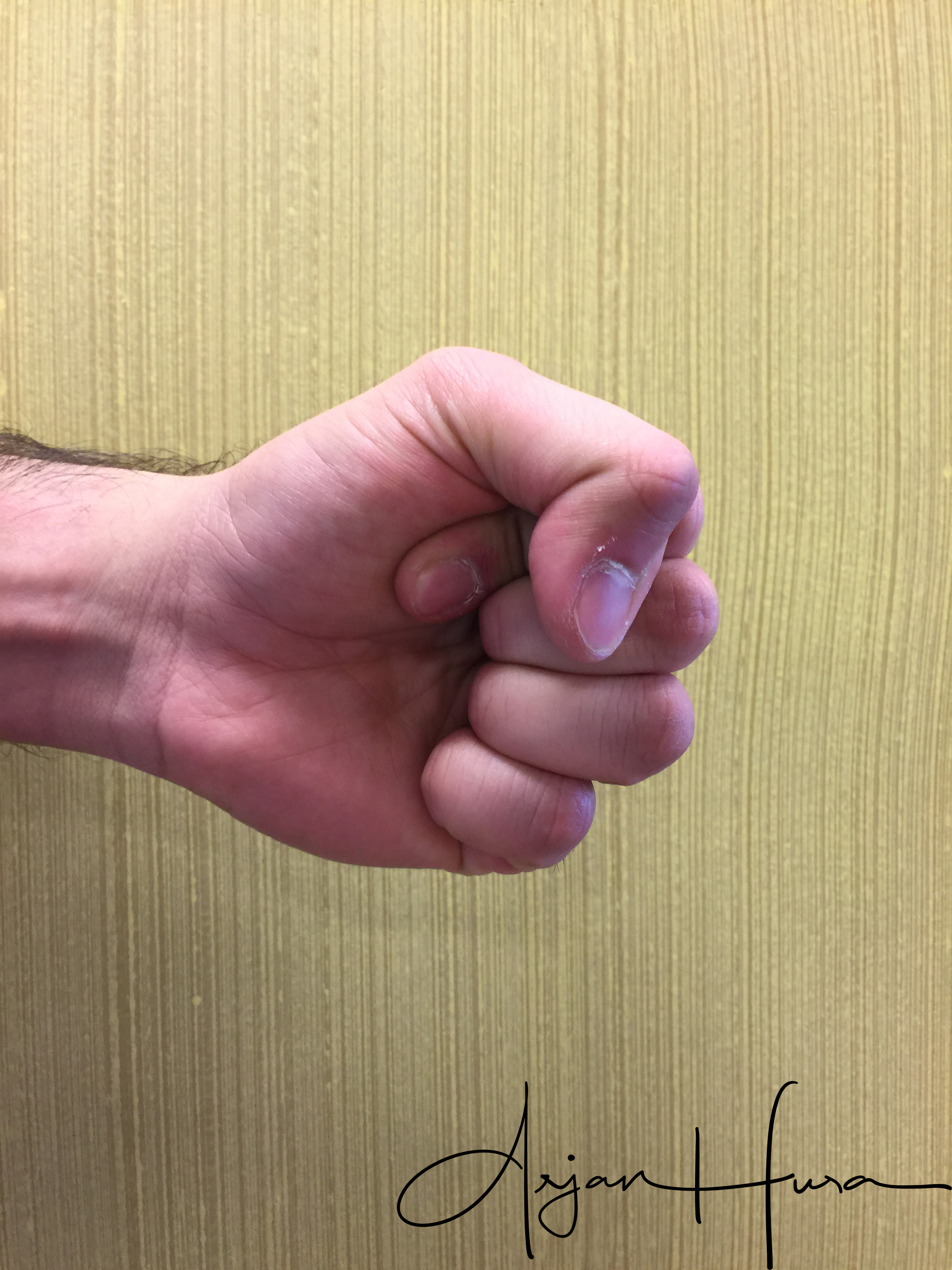 The Anatomy Of Karate Hand Techniques - Arjan Hura, MD