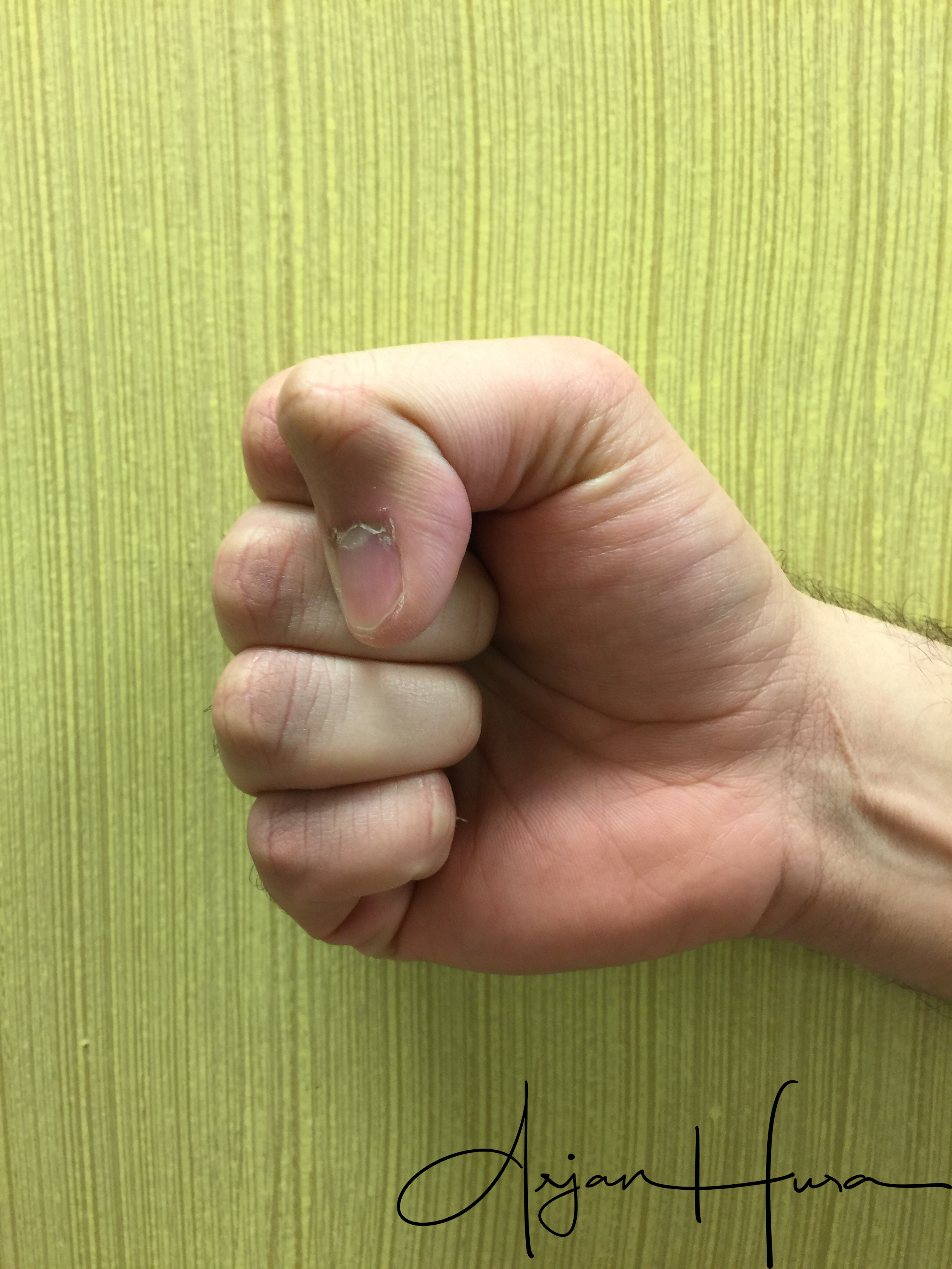 The Anatomy Of Karate Hand Techniques - Arjan Hura, MD