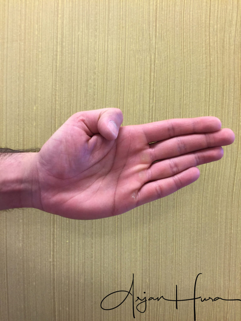 Seiryuto | Arjan Hura, MD