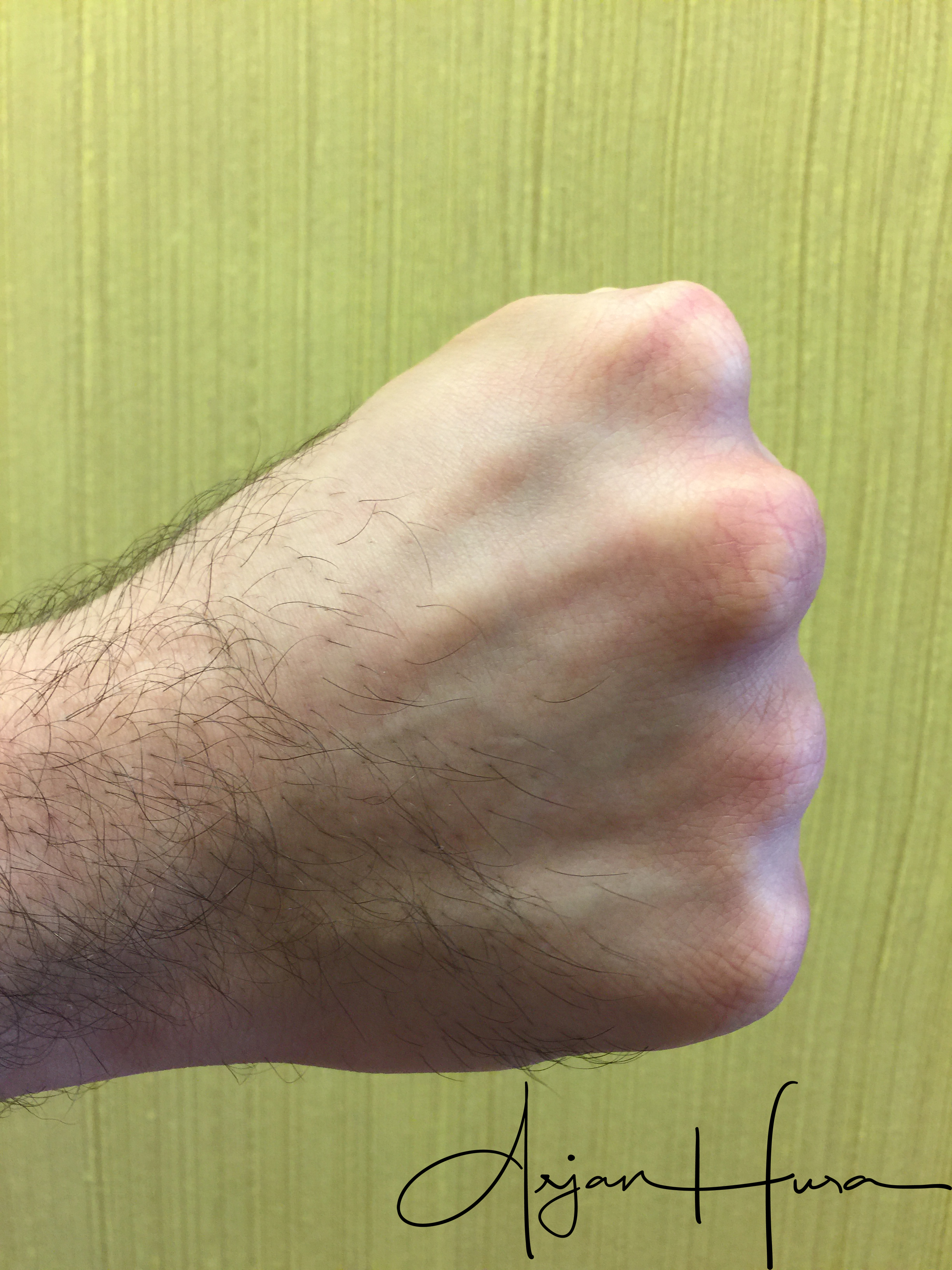 The Anatomy Of Karate Hand Techniques - Arjan Hura, MD